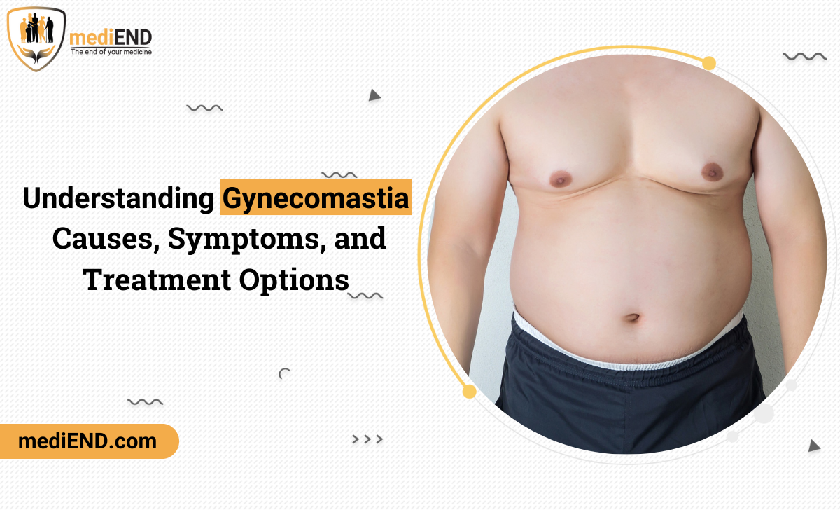 Gynecomastia Causes Symptoms And Treatment Options Youmobs